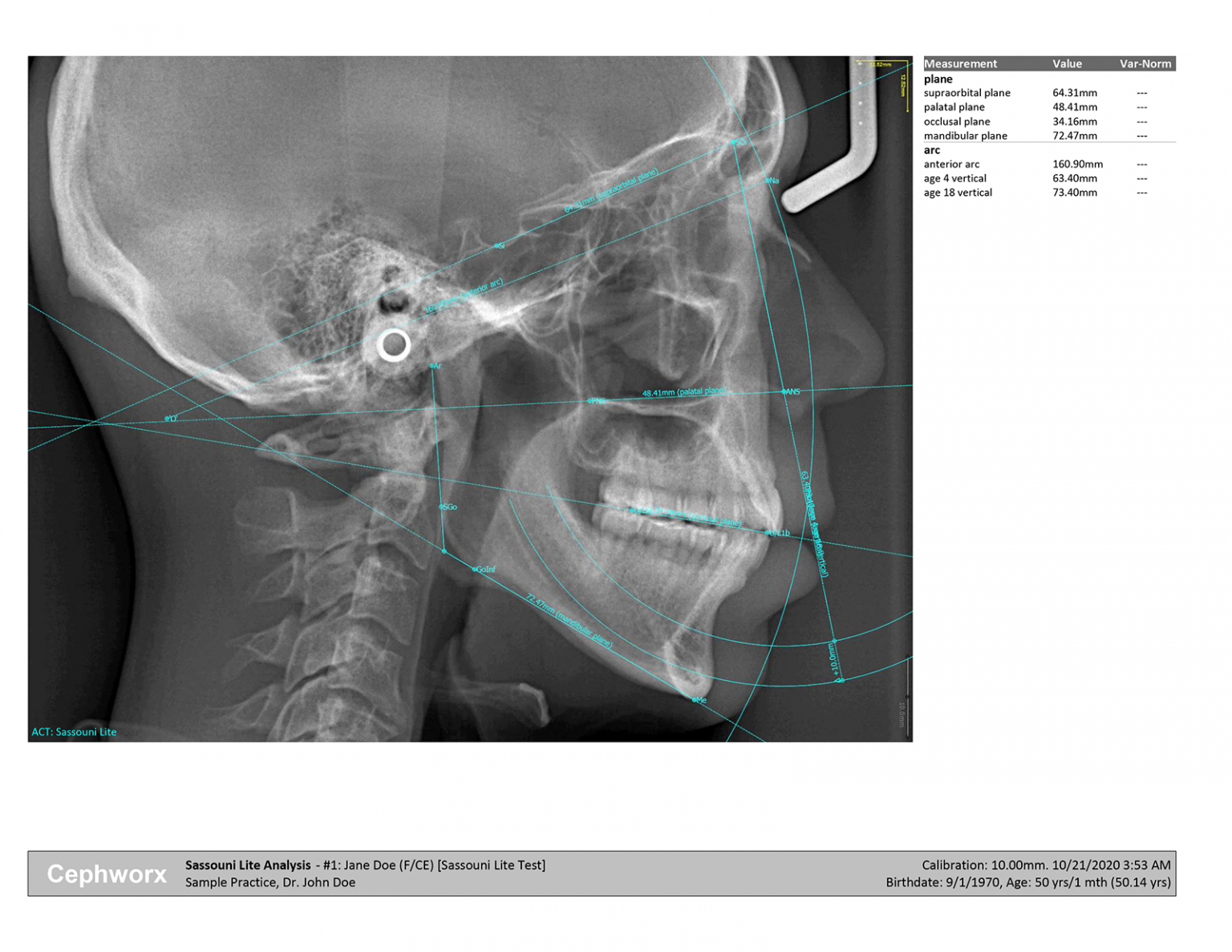 Cephworx - Cephalometric Tracings Made Easier with Less Work!