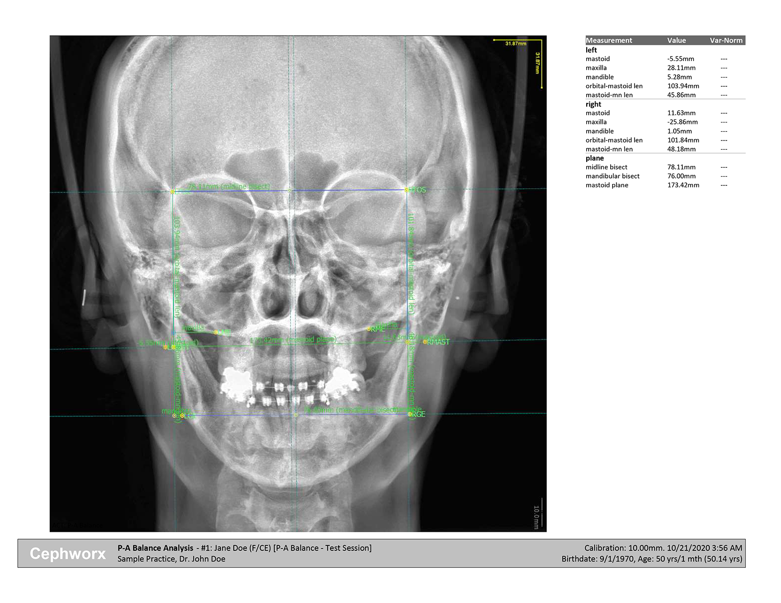 Cephworx - Cephalometric Tracings Made Easier with Less Work!